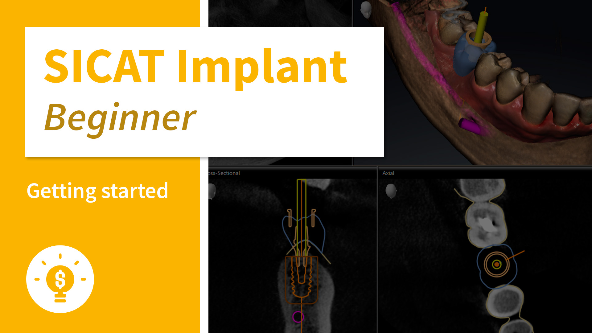 SICAT Implant – Getting started. Import of DICOM Data & General ...